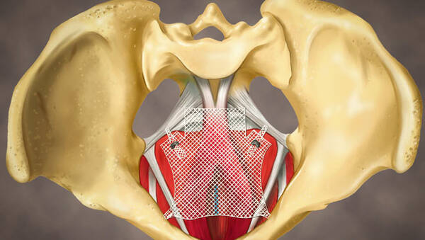A Female Surgical Nightmare - In These Times